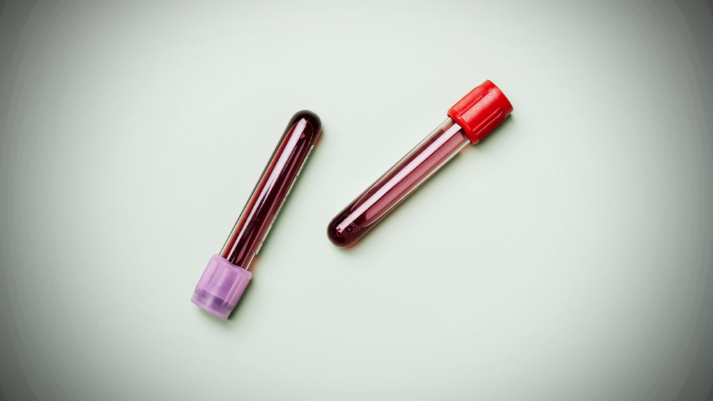 We tested EU politicians’ blood for PFAS. Here’s what they had to say ...
